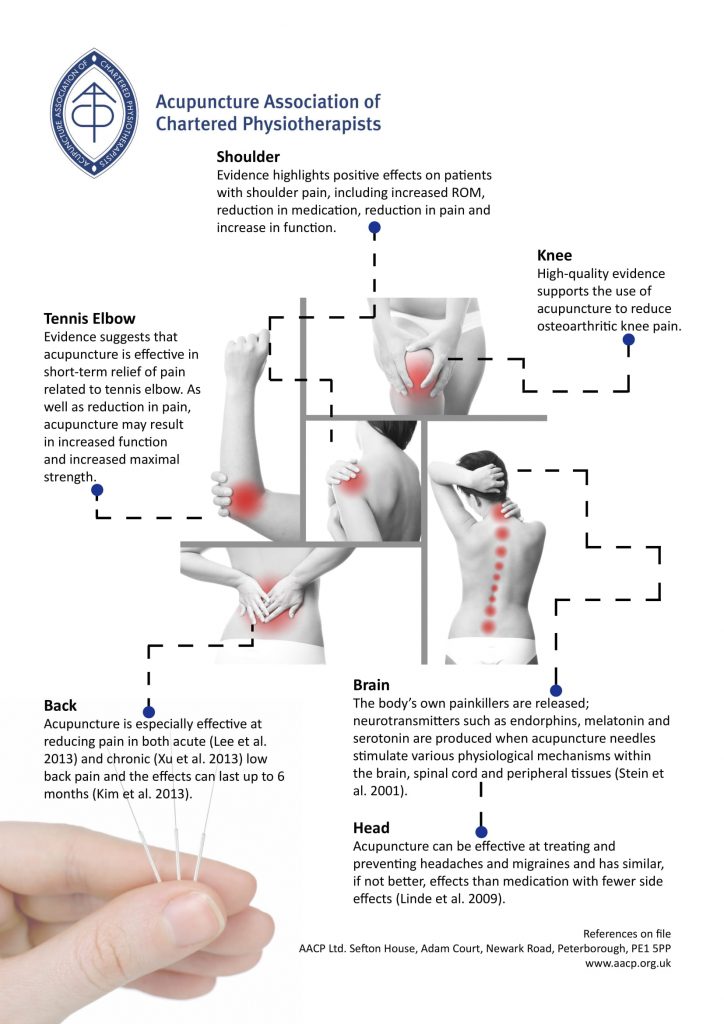 Acupuncture Day - The Iveson Clinic for Physiotherapy and Chiropractic